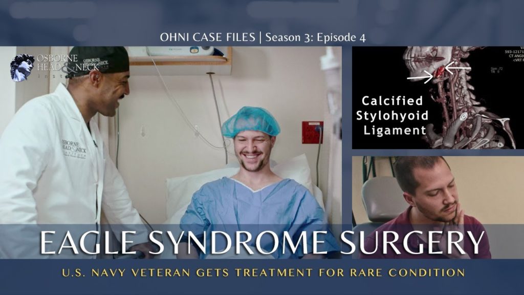 Eagle Syndrome Styloidectomy Videos | Eagle Syndrome Treatment Specialist